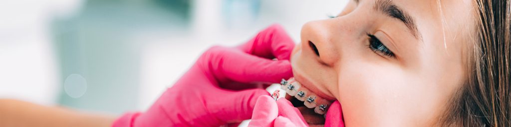 Werkwijze – Orthodontiepraktijk Vianen | Alexander Nassy